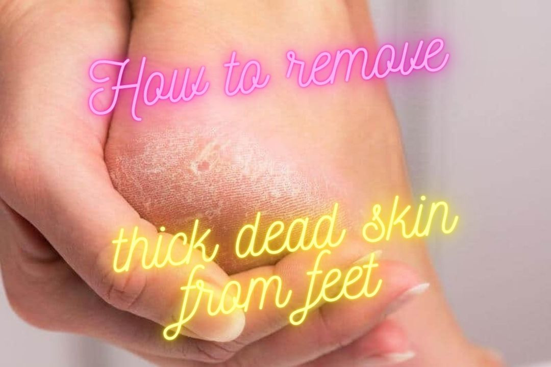 How To Remove Thick Dead Skin From Feet 5 Ways To Smoothen Your Feet how-to-remove-thick-dead-skin-from-feet-5-ways-to-smoothen-your-feet